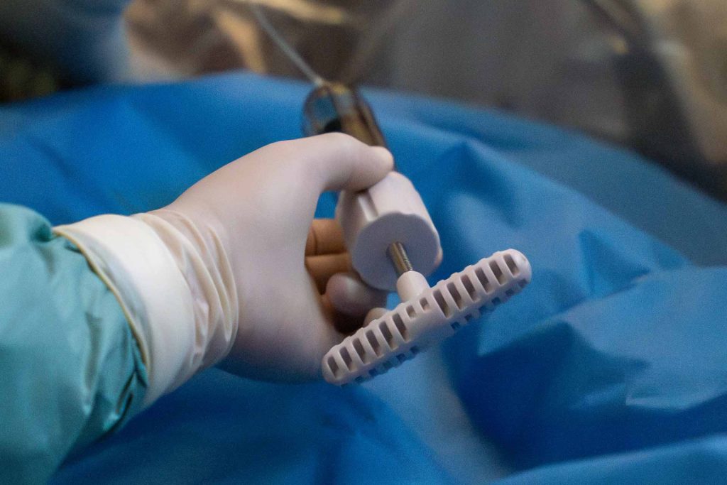 Vertebroplasty: What to Expect and Its Benefits - Algarve Pain Centre
